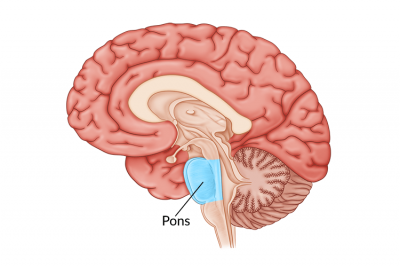 Understanding Pontine Stroke: Looking at the Symptoms, Effects ...