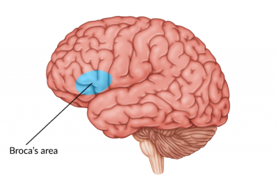 Damage to Broca’s Area: Causes, Symptoms, & Rehabilitation Process ...