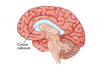 Corpus Callosum Damage: What to Expect and How to Treat It – Zao Rehab