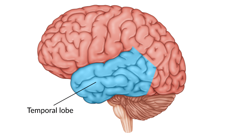 Temporal Lobe Stroke: What to Expect on the Road to Recovery – Zao Rehab